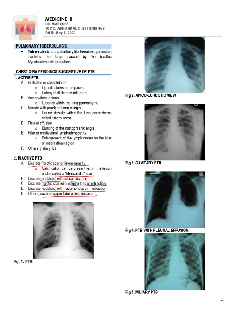 Abnormal Chest Findings | PDF | Lung | Pneumonia