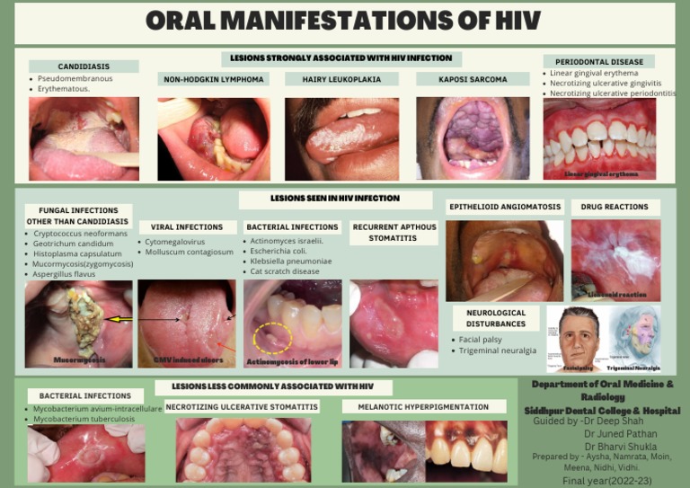 Oral Manifestation of Hiv | Download Free PDF | Medical Specialties ...