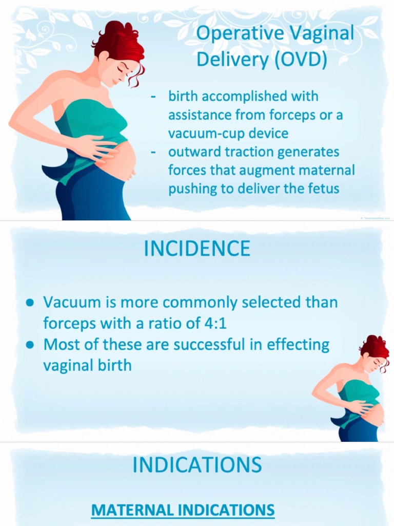 OB-Operative Vaginal Delivery Nov 21,2022 | PDF