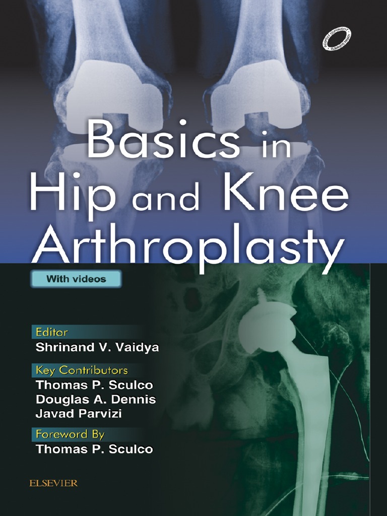 Basics Arthroplasty Shrinand | PDF | Surgery | Obesity