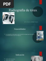 Radiografía de Tórax Normal - Patrón Intersticial | PDF | Pulmón | Tórax