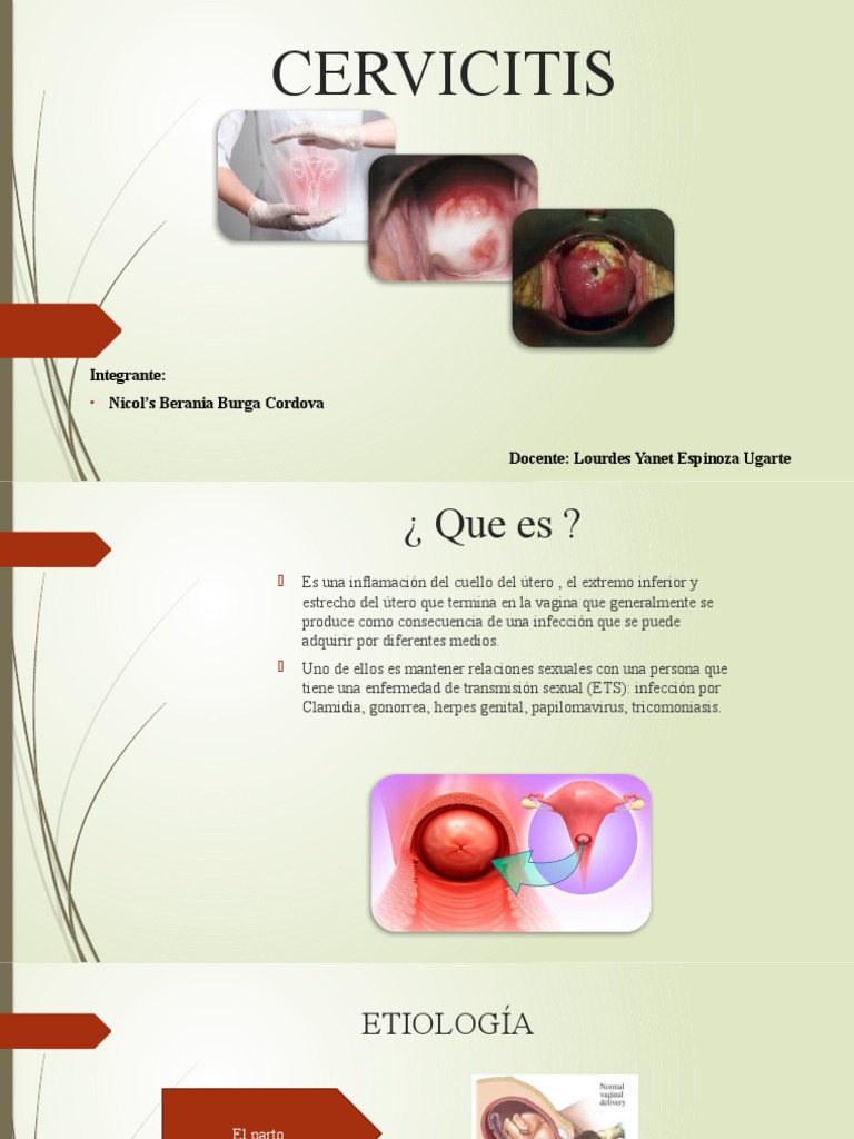 Cervicitis 3 | PDF | Infección transmitida sexualmente | Condón