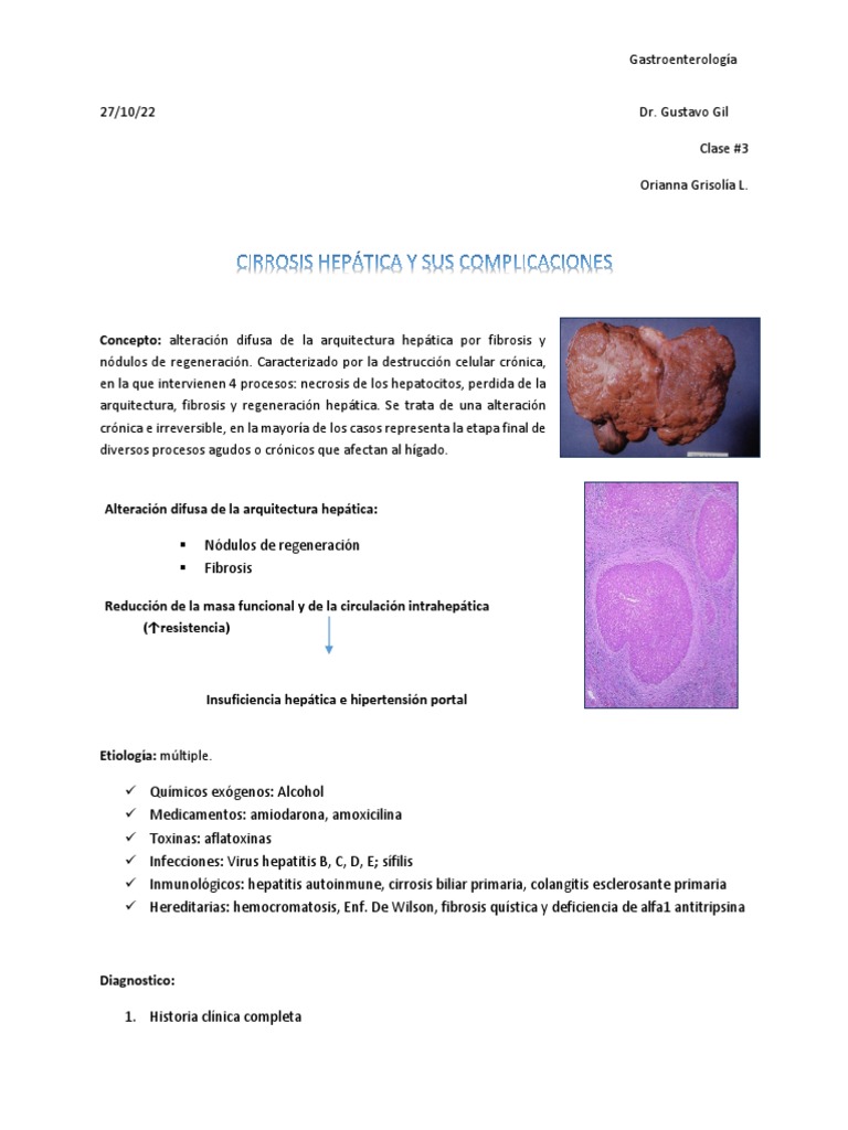 Cirrosis Hepática y Sus Complicaciones | PDF | Cirrosis | Hepatitis