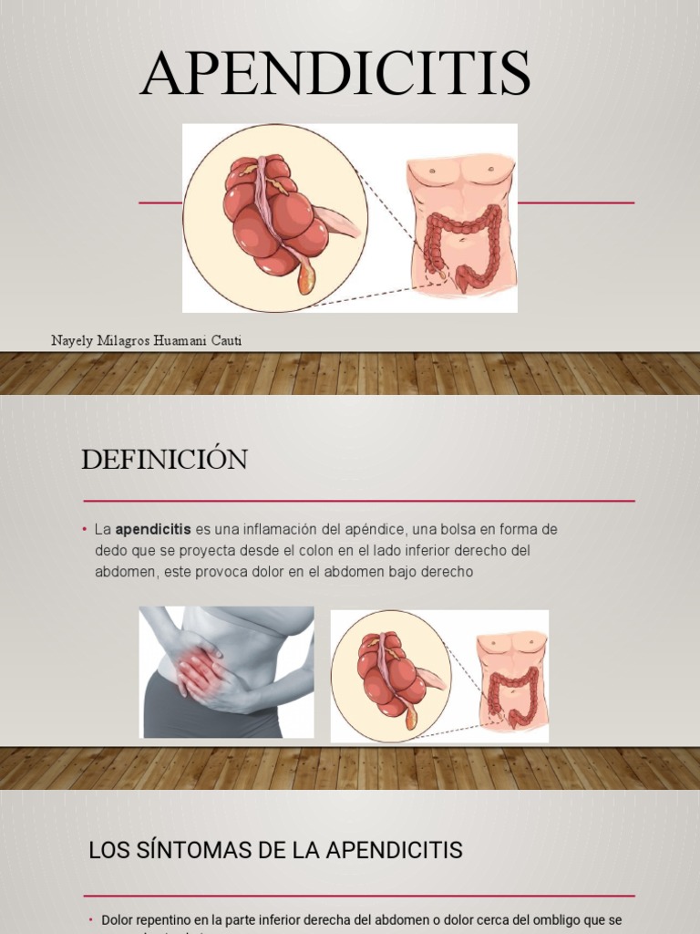 Apendicitis | PDF | Cirugía | Medicina CLINICA