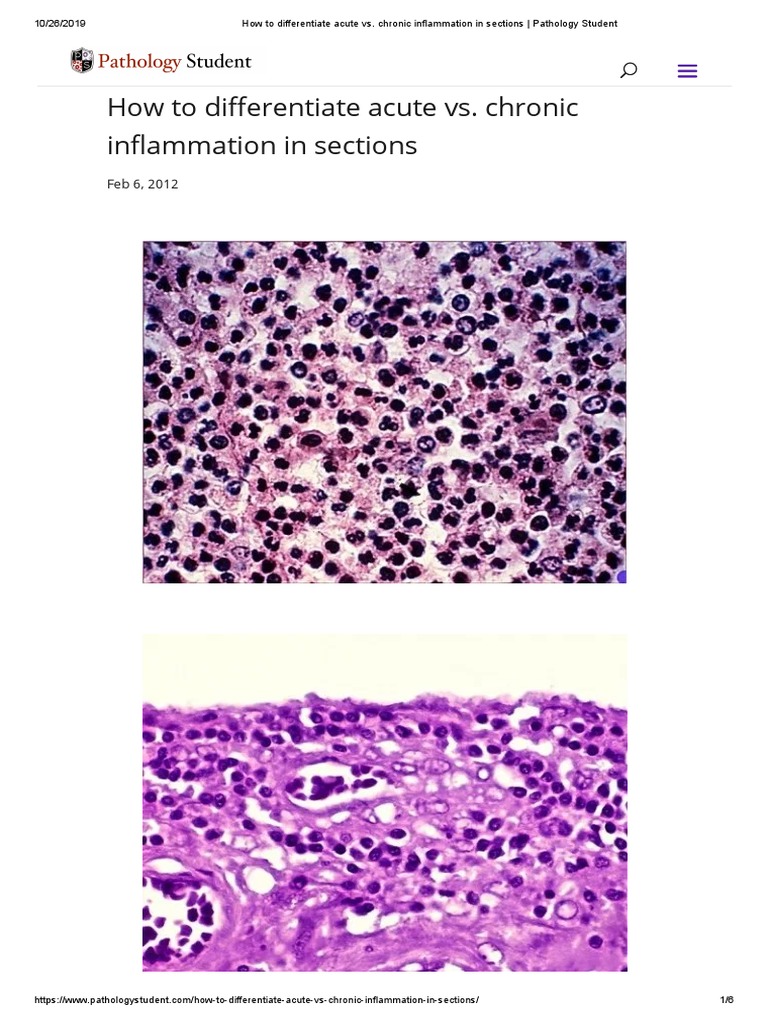 How To Differentiate Acute vs. Chronic Inflammation in Sections - Pathology Student | PDF ...
