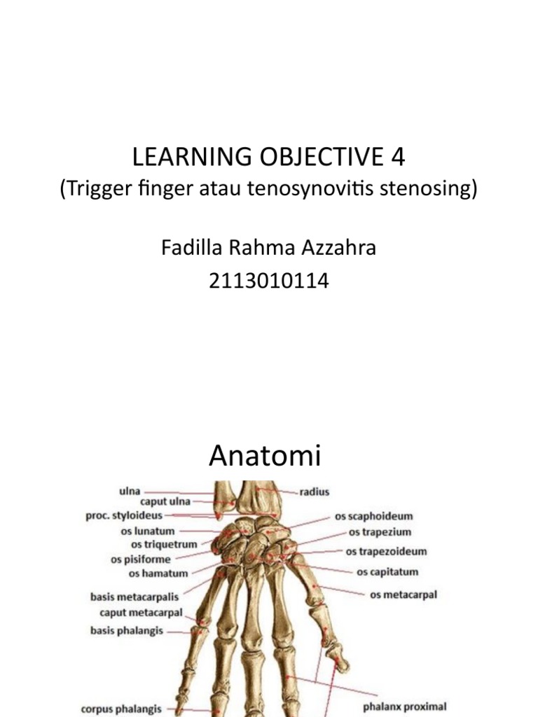 Learning Objective 4: (Trigger Finger Atau Tenosynovitis Stenosing) | PDF