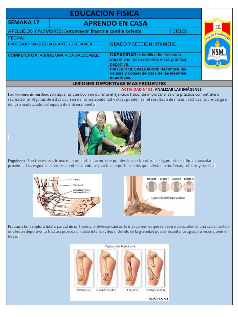 Semana 17 - Lesiones Deportivas | PDF | Músculo | Lesión