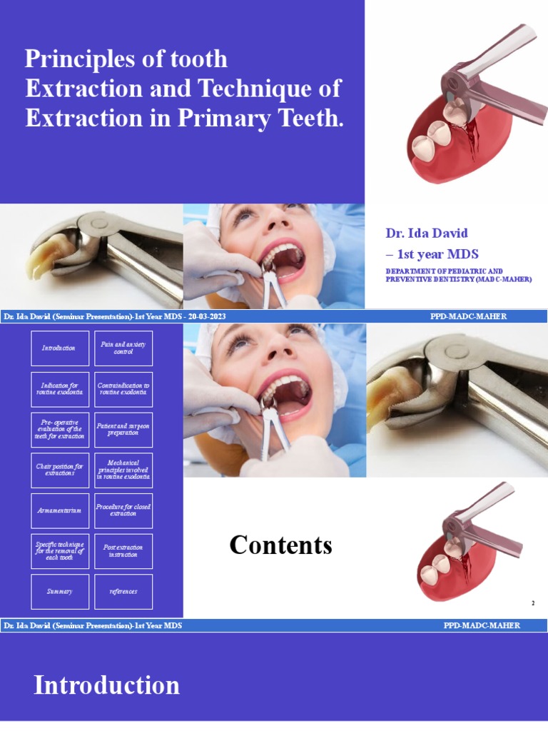 Technique of Extraction in Primary Teeth | PDF