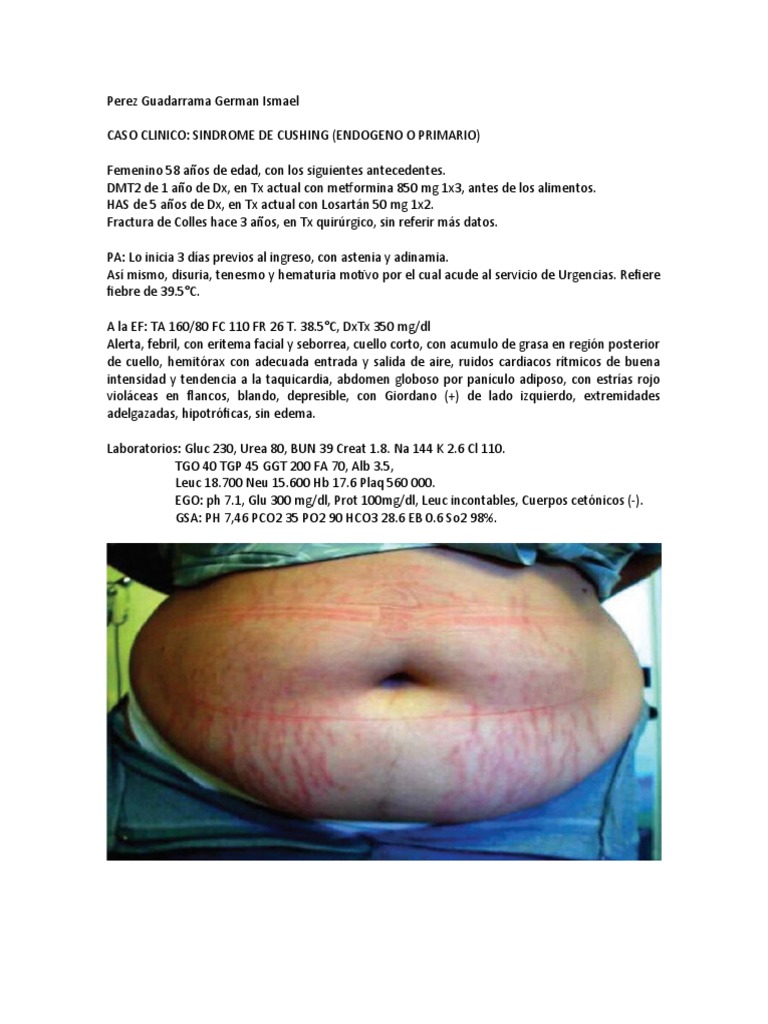 Caso Clinico Sindrome de Cushing Endogeno (1) | PDF | Hormona ...