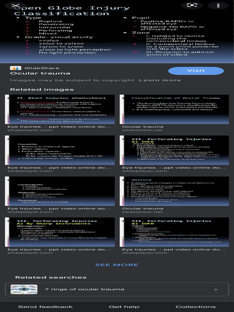 Betts Criteria Trauma - Google Search | PDF