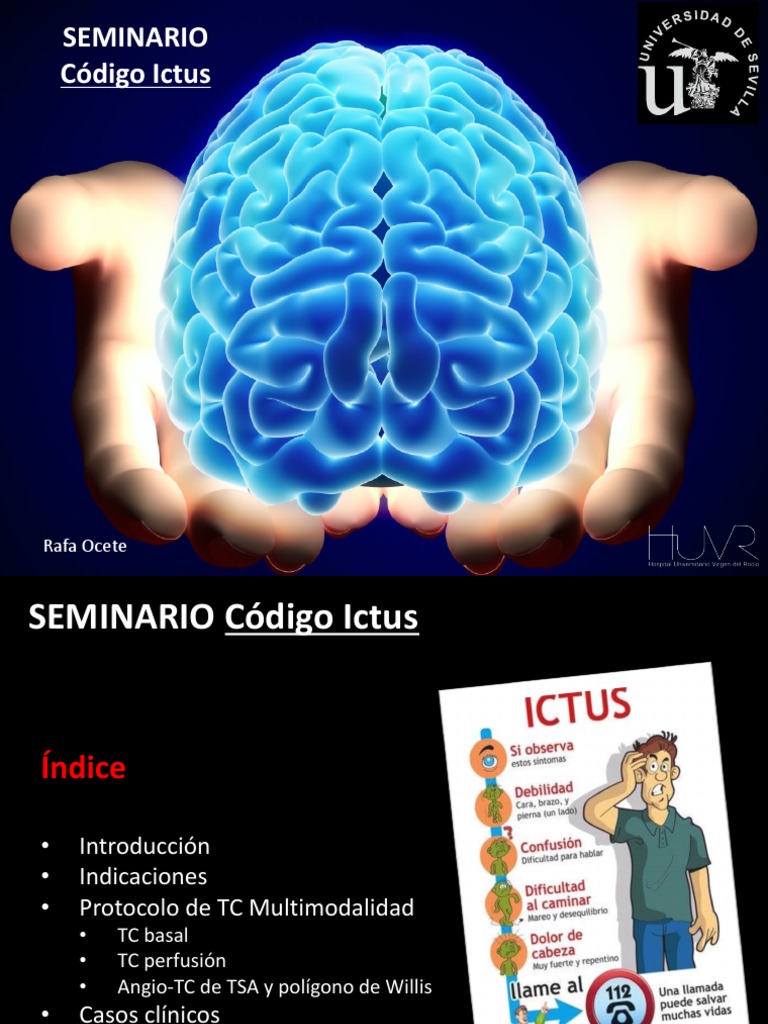 Seminario Código Ictus 2021 | PDF | Carrera | Isquemia