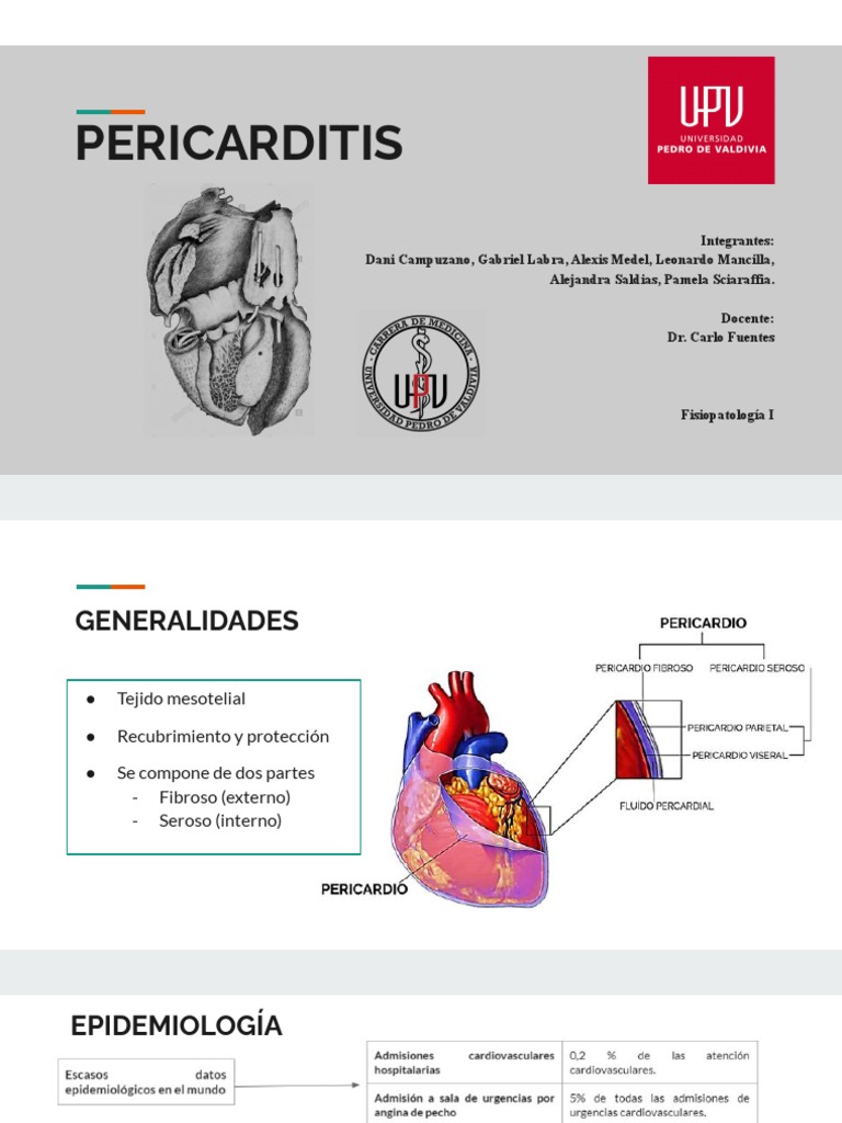 Pericarditis PPT 2.0 | PDF | Infarto de miocardio | Cardiología