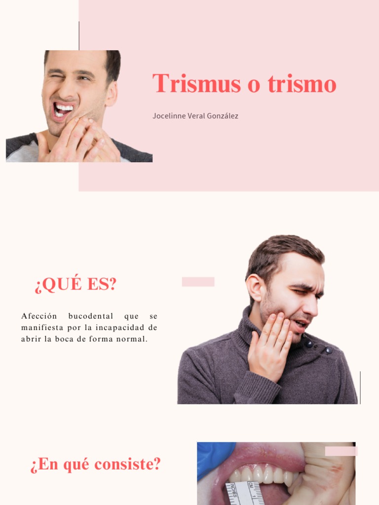 Trismus o Trismo | PDF