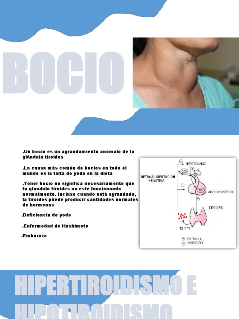 bocio, hiper e hipo 2.0 | PDF