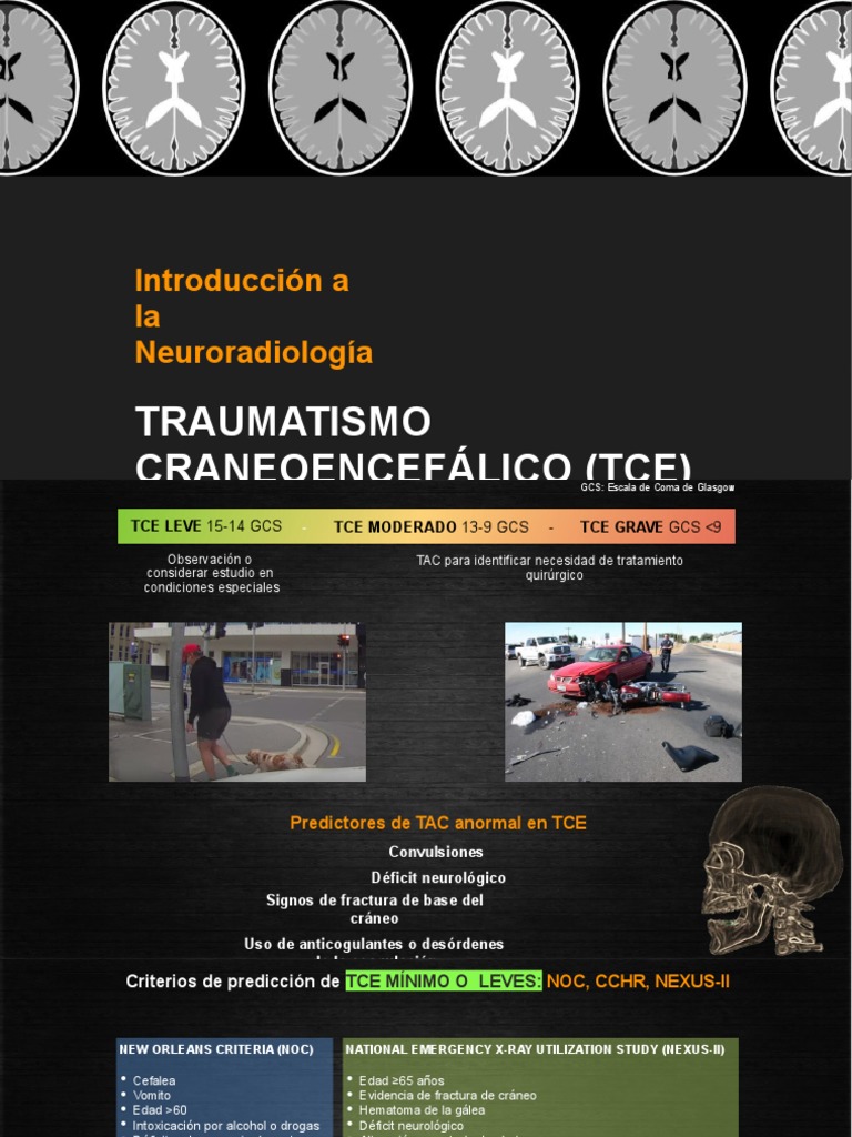 Imagenologia en Tce | PDF | Sistema nervioso | Neurociencia