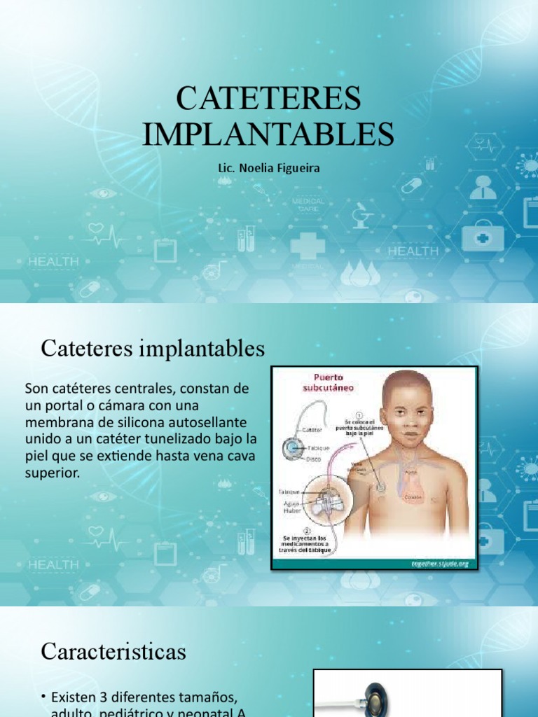 Cateteres Implantables Original | PDF | Causas de la muerte | Medicina
