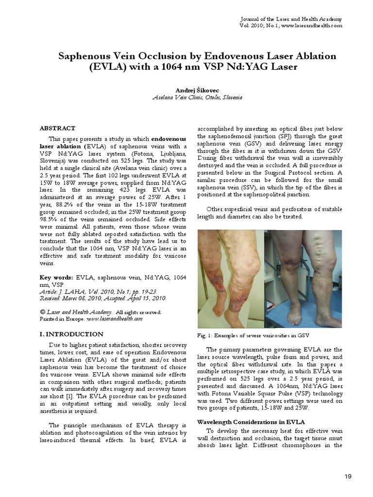 EVLA | PDF | Laser | Varicose Veins