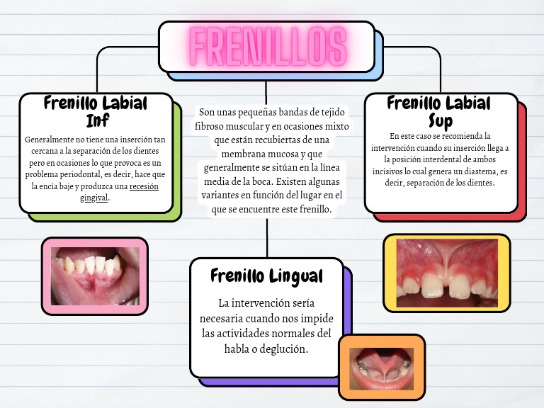 Frenillos | PDF