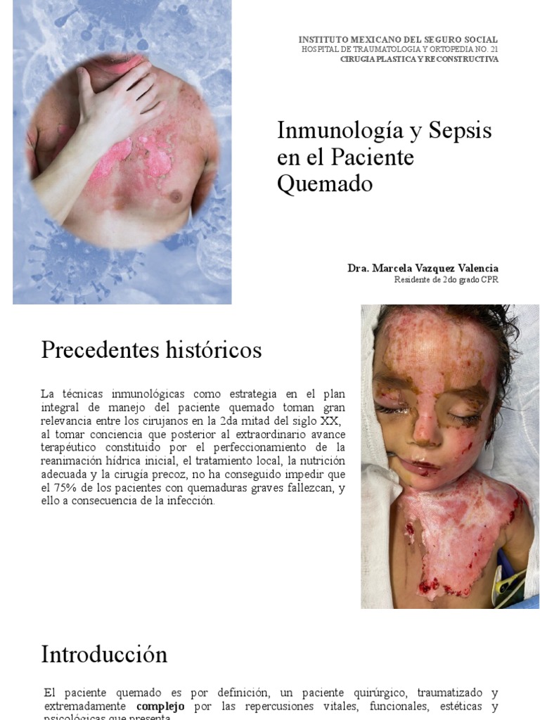 Burn Injury Immunology and Sepsis MVV | PDF | Sistema inmune | Septicemia