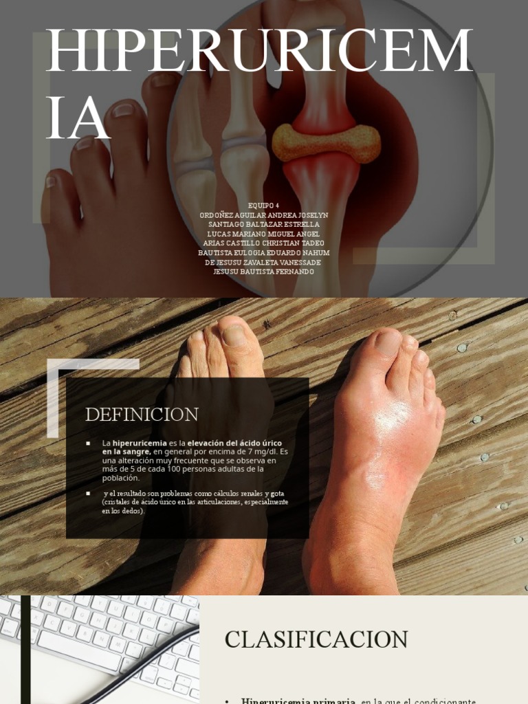 Hiperuricemia Final | PDF | Gota | Medicina CLINICA