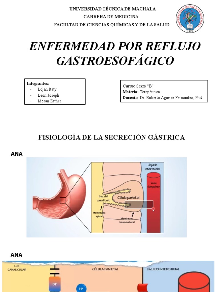 Erge | PDF | La enfermedad por reflujo gastroesofágico | Medicina CLINICA