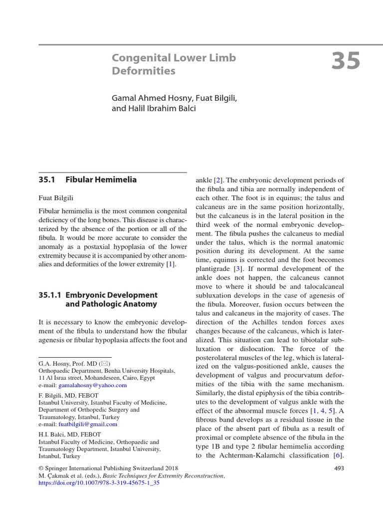 Congenital Lower Limb Deformities | PDF | Ankle | Knee