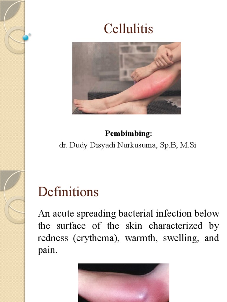 SELULITIS | PDF | Causes Of Death | Diseases And Disorders