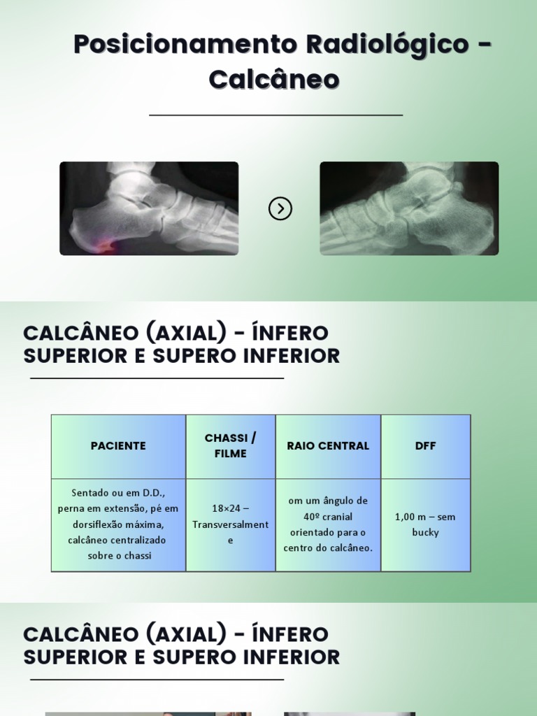 Calcaneo - Posicionamento | PDF