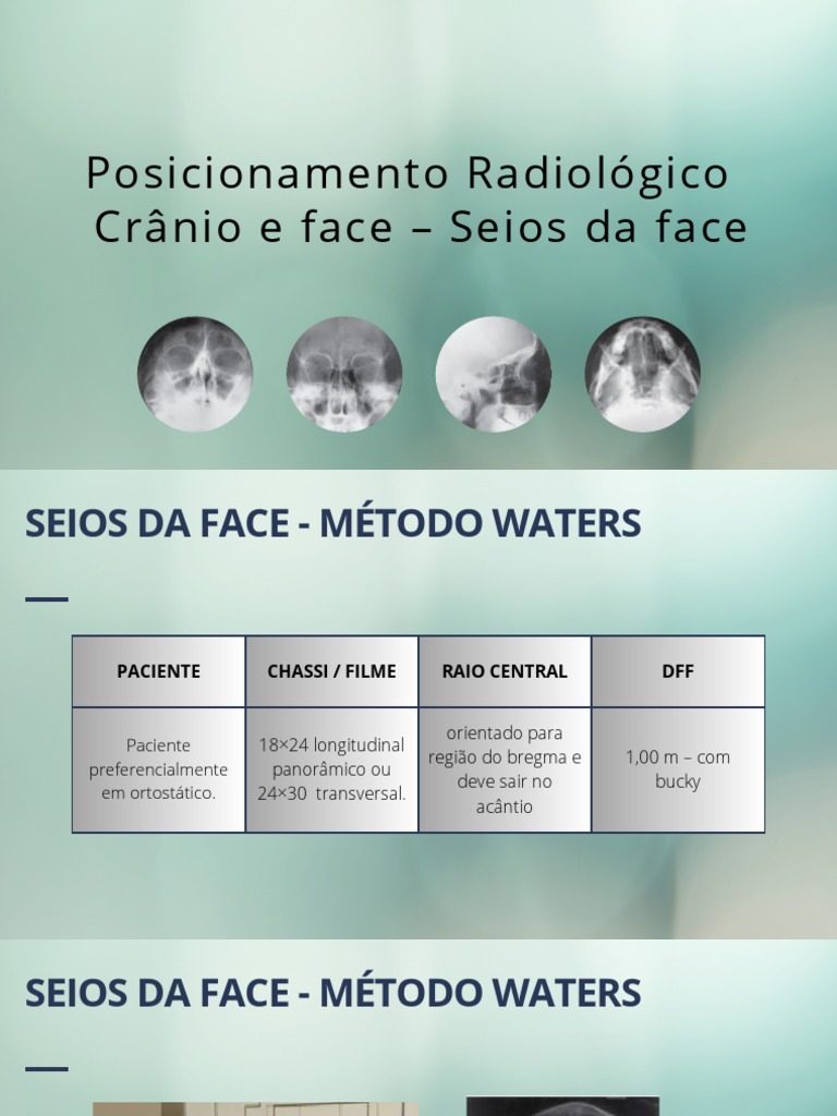 Posicionamento Radiológico dos Seios da Face | PDF