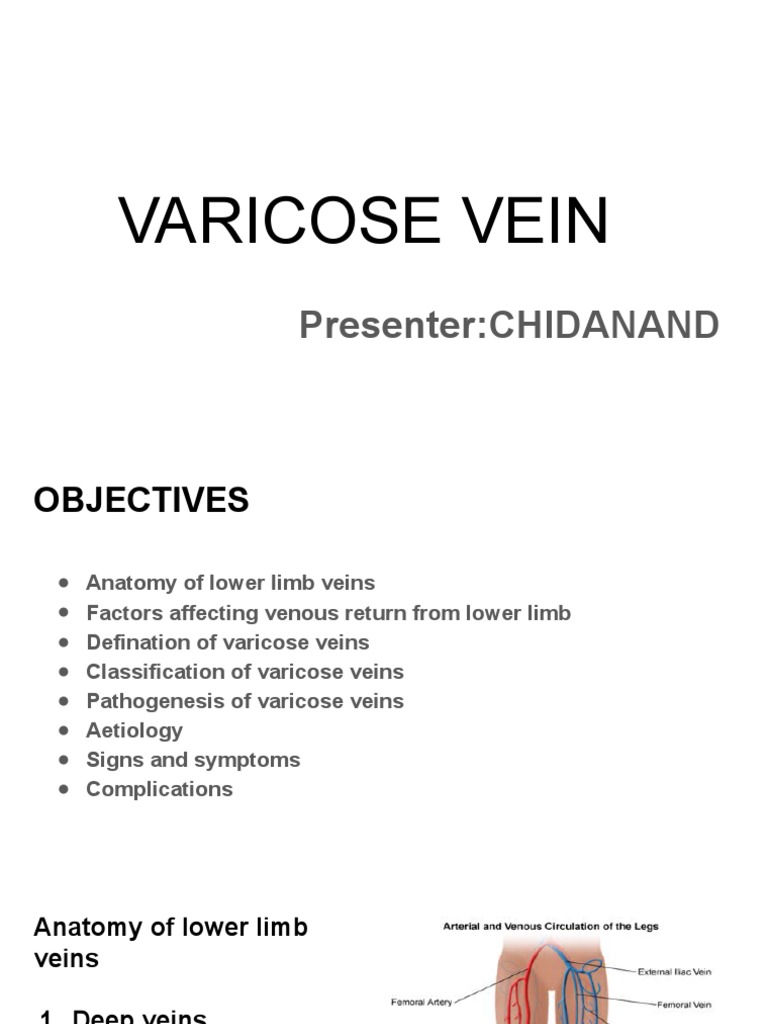 Varicose Vein | PDF | Vein | Varicose Veins