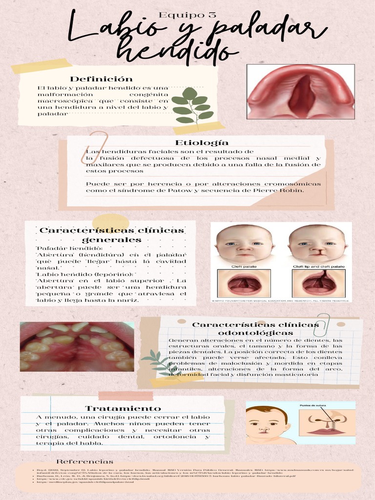 Paladar Hendido | PDF | Rasgos faciales | Medicina CLINICA