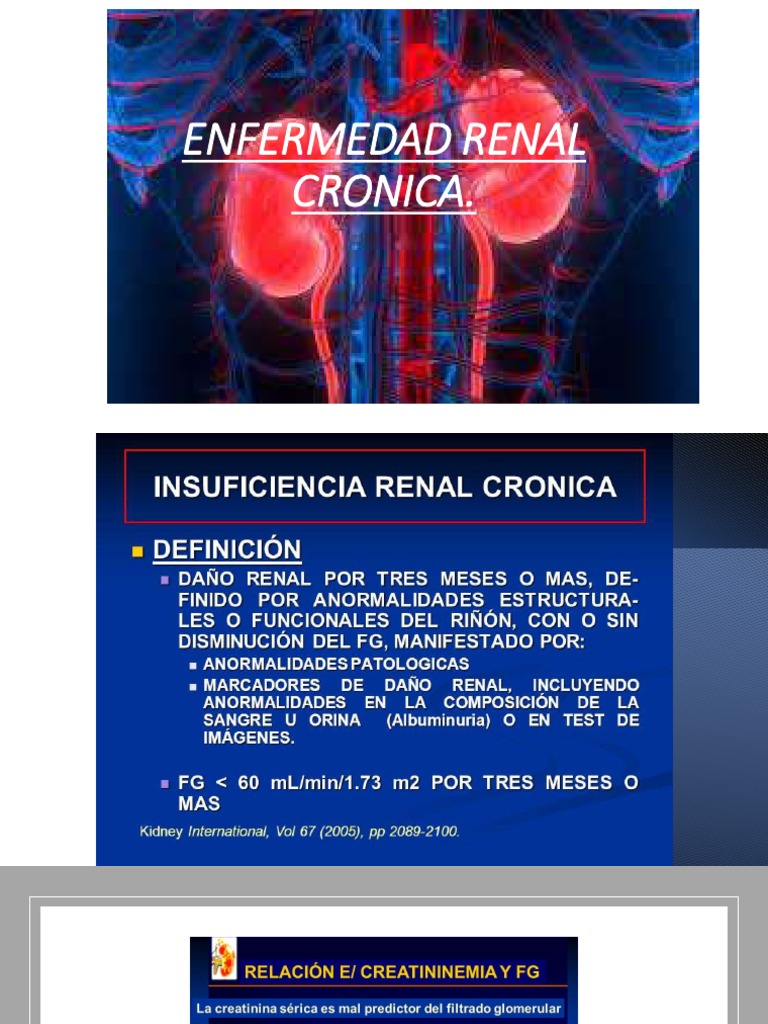 Complicaciones y diagnóstico de ERC | PDF | Enfermedad renal crónica ...