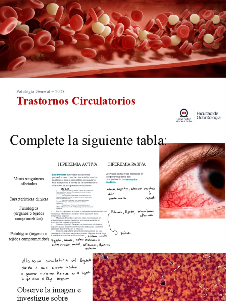 Hiperemia y Trastornos Circulatorios | PDF | Embolia | Trombo