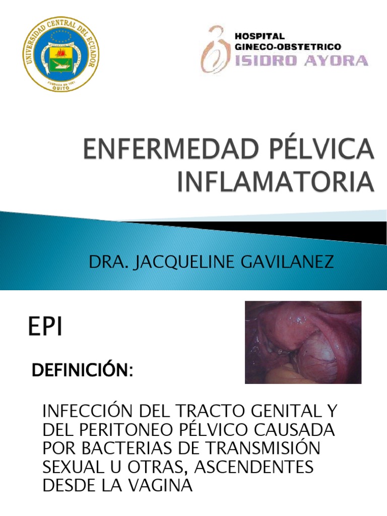 13.0 Enfermedad Pelvica Inflamatoria | PDF | Infección transmitida sexualmente | Menstruación