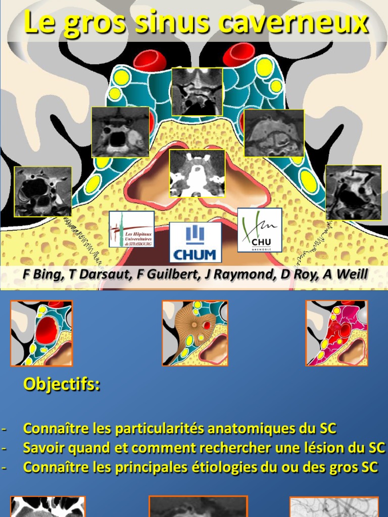Anatomie et pathologies du sinus caverneux | PDF | Anatomie humaine ...