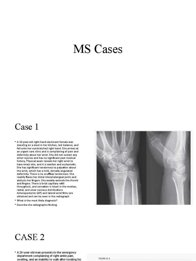 Cases MS | PDF | Anatomical Terms Of Motion | Shoulder