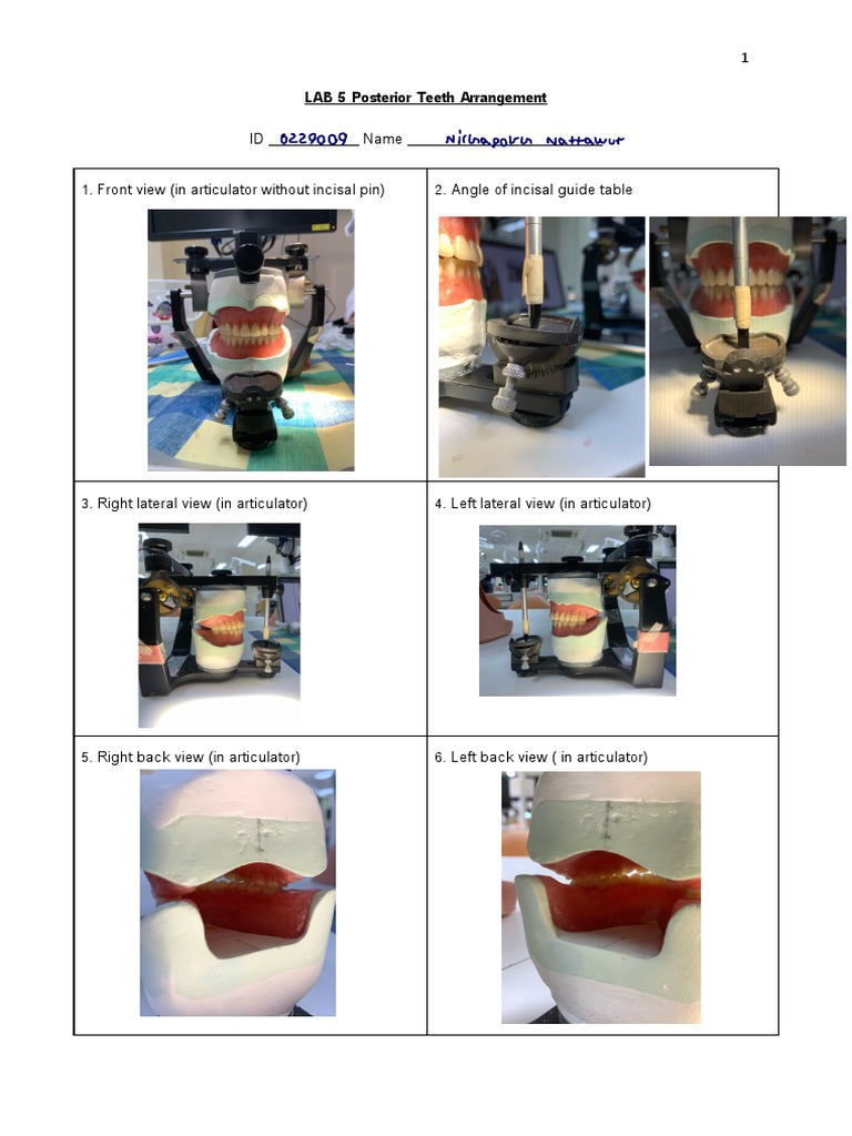 Posterior Teeth Arrangement Guide | PDF | Dentistry | Human Anatomy