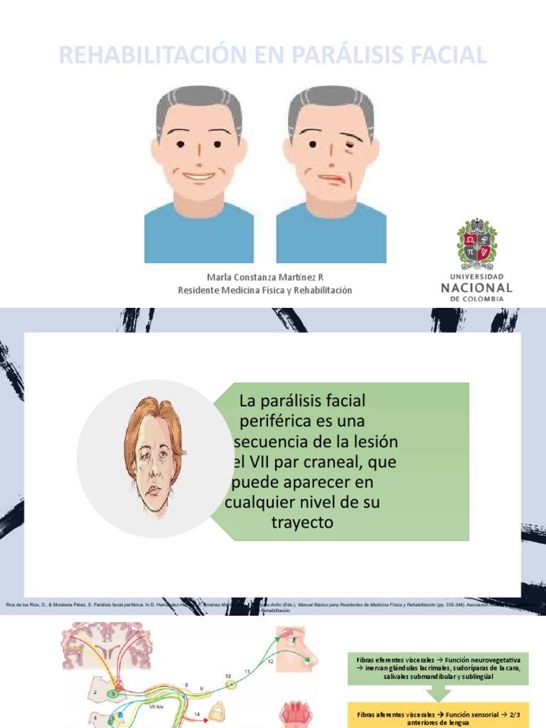 Paralisis Facial | PDF | Anatomía | Enfermedades y trastornos
