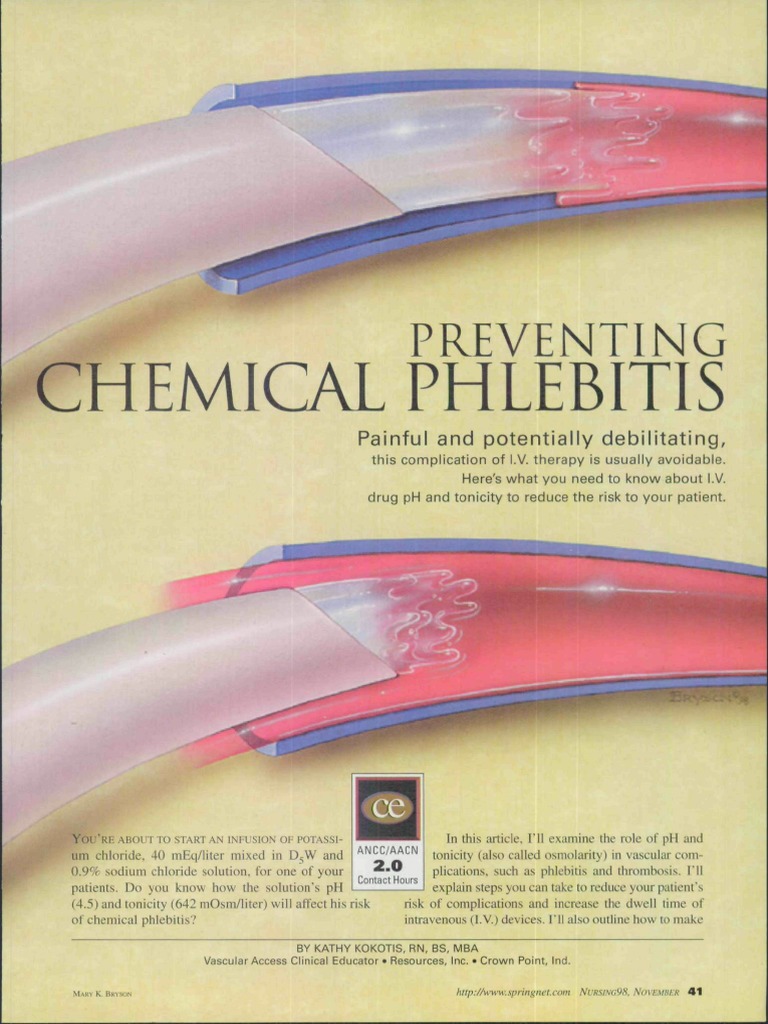Preventing IV Chemical Phlebitis | PDF | Intravenous Therapy | Saline (Medicine)