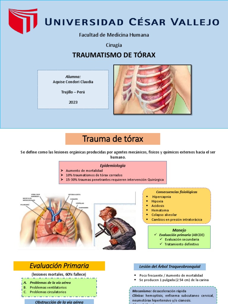 Traumatismo de Torax - Claudia Aquise | PDF | Causas de la muerte | Medicina CLINICA