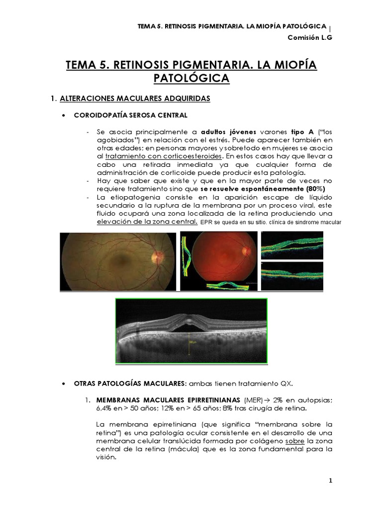 Tema 5. - Retinosis Pigmentaria | PDF | Percepción visual | Ojo humano