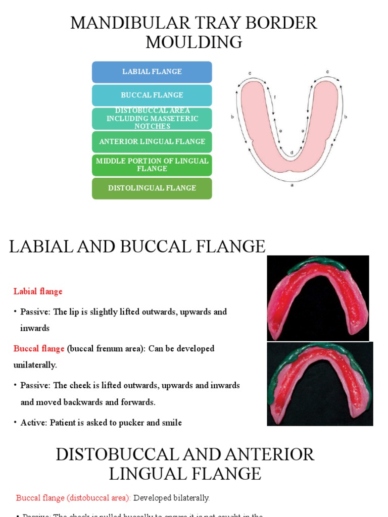 Mandibular Tray Border Moulding | PDF