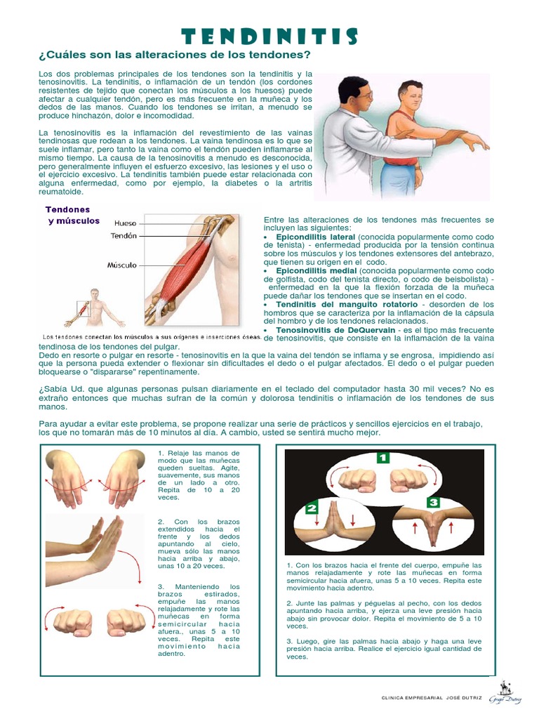 Tendinitis y Tenosinovitis en Manos | PDF | Tendón | Especialidades Medicas