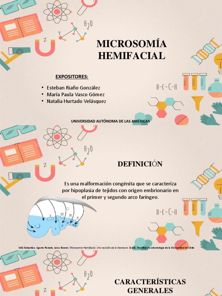 Microsomía Hemifacial | PDF | Especialidades Medicas | Anatomía