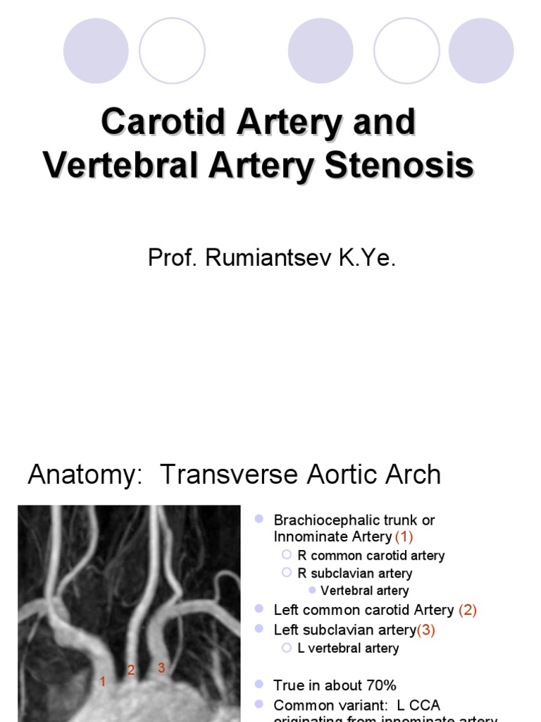 Carotid Artery Disease | PDF | Common Carotid Artery | Medical Specialties