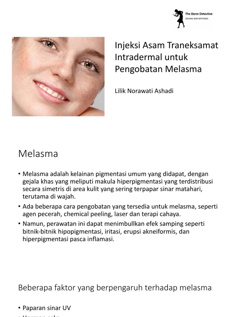 Injeksi Asam Traneksamat Intradermal Untuk Pengobatan Melasma | PDF