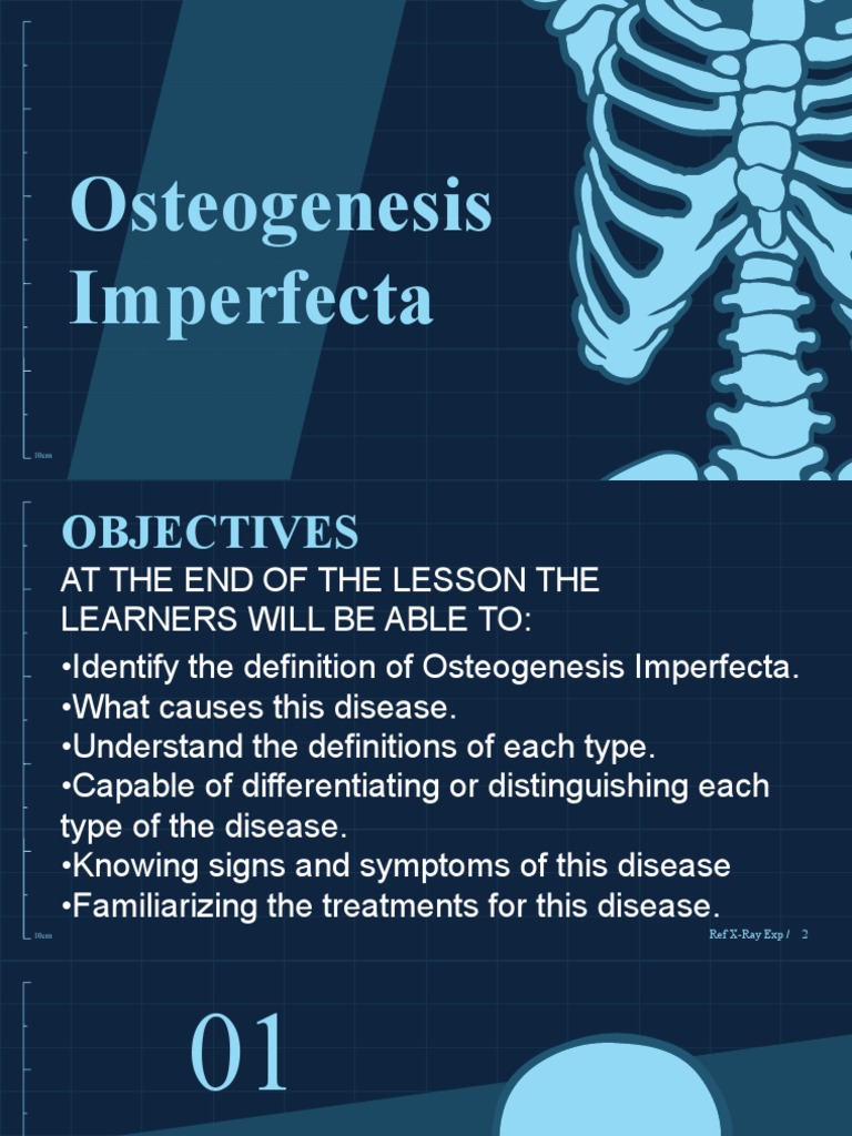 Osteogenesis Imperfecta | PDF | Musculoskeletal System | Medicine
