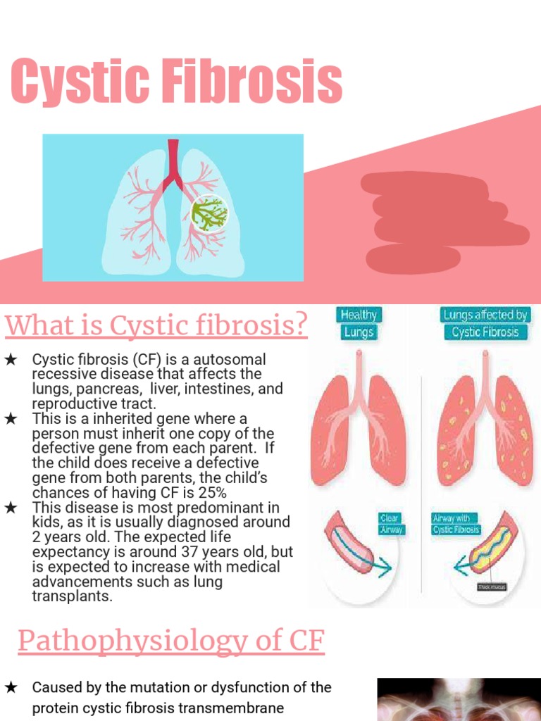 Understanding Cystic Fibrosis: Overview & Care | PDF | Diseases And ...