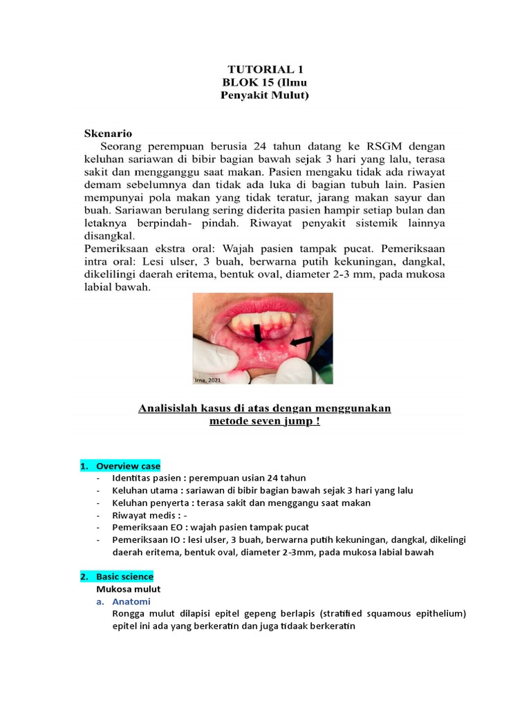 Sariawan: Diagnosis dan Perawatan SAR | PDF
