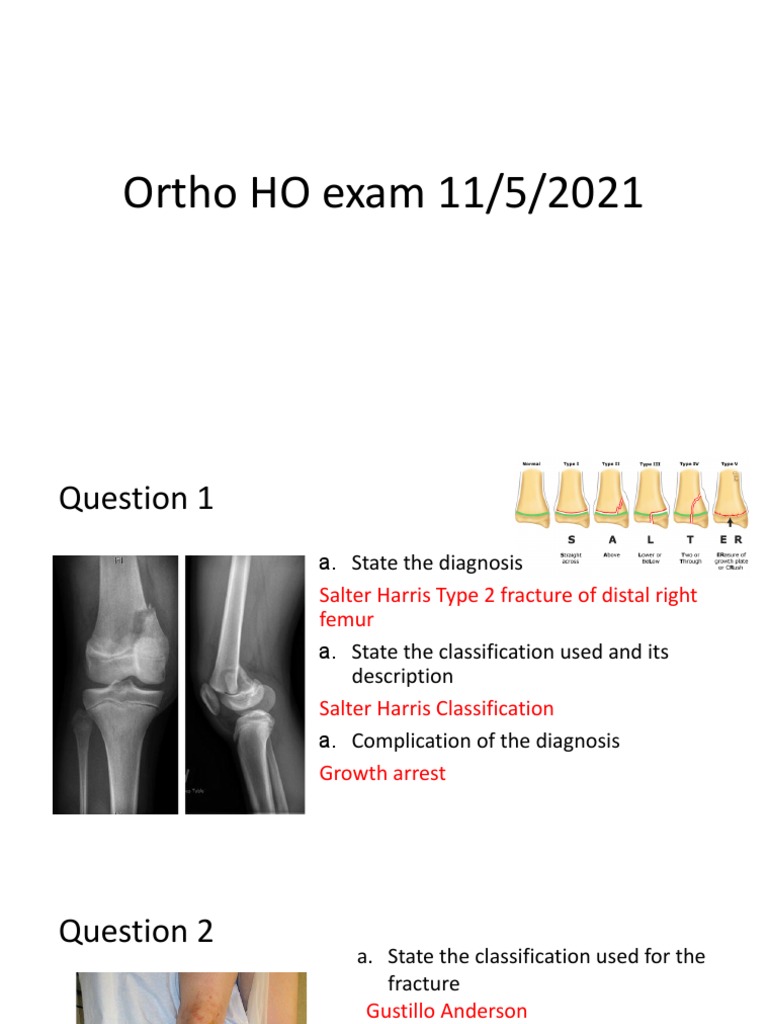 Ortho HO Exam NS Answer | PDF | Clinical Medicine | Medicine